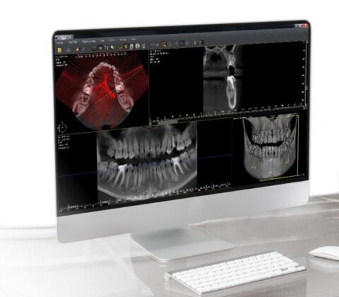Quickvision 3D Implant planning software - Owandy Radiology